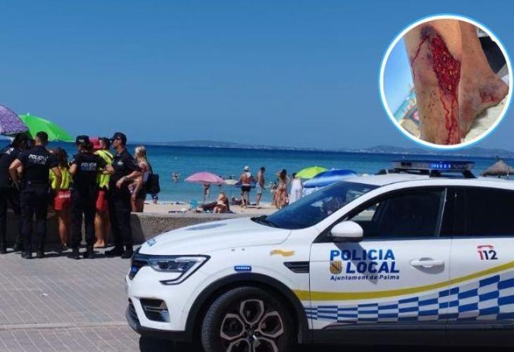 Beach evacuated in Mallorca after tourist is attacked by fish